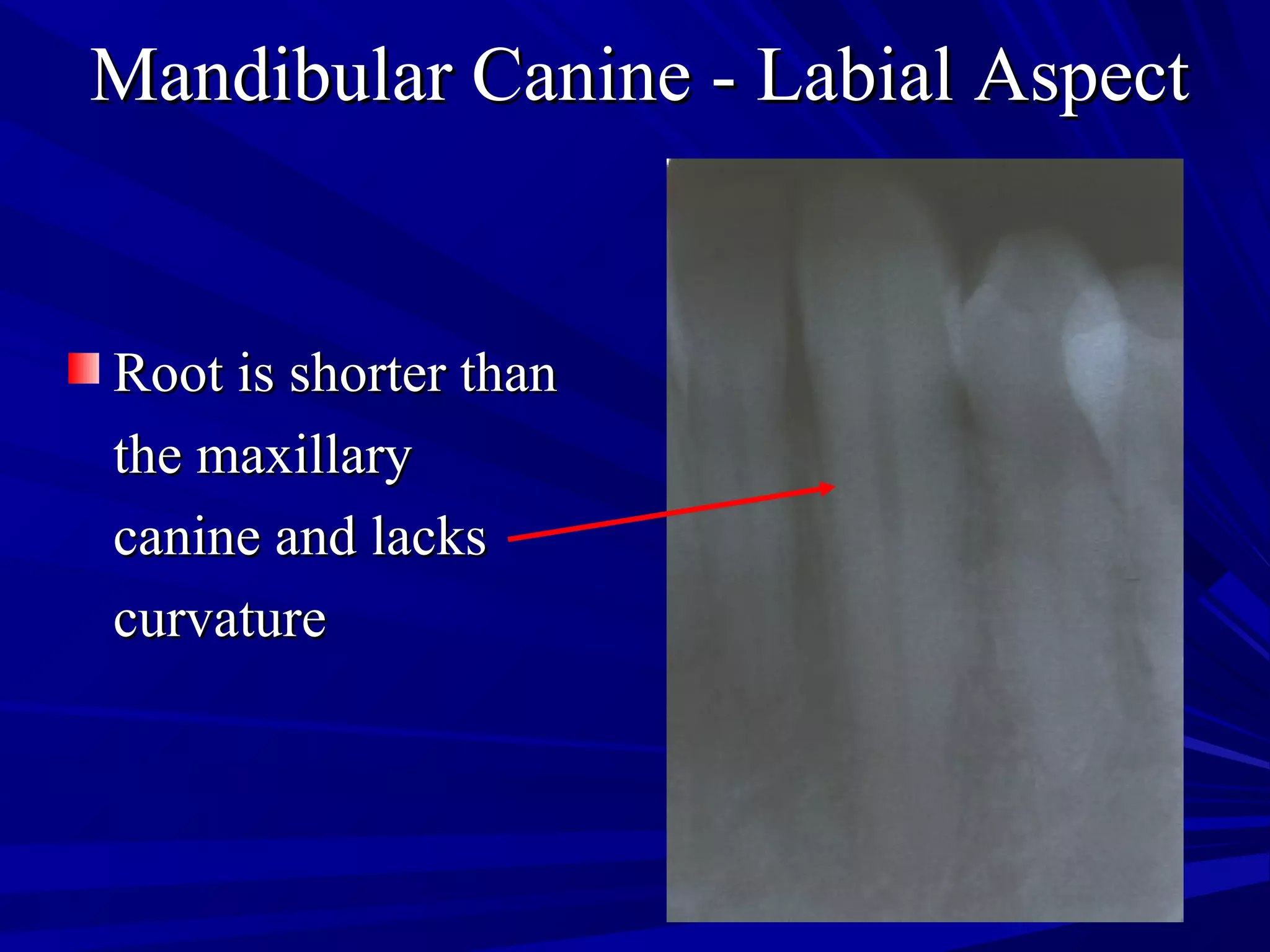 Maxillary and Mandibular Canines | PPT