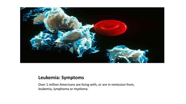 4 causes of leukemia | PPTX | Cancer | Diseases and Conditions