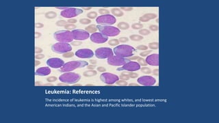 4 causes of leukemia | PPTX