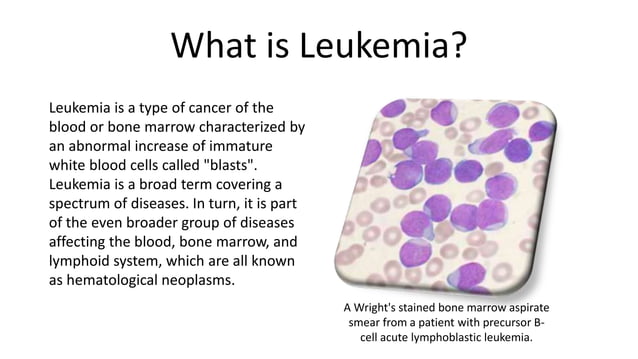 4 causes of leukemia | PPTX | Cancer | Diseases and Conditions