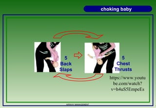 Choking | PPT