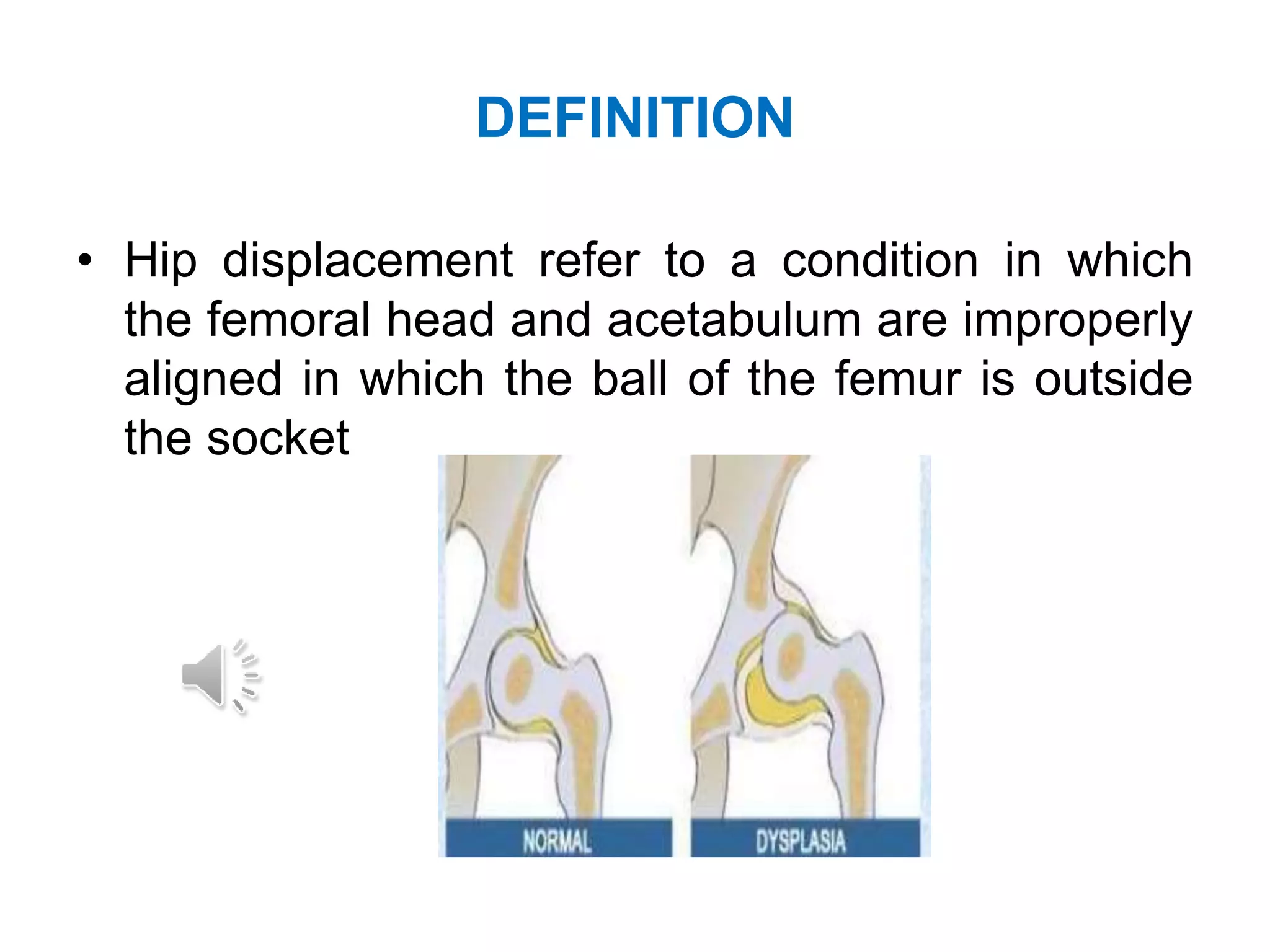 CONGENITAL DISORDERS IN MUSCULOSKELETAL SYSTEM | PPTX