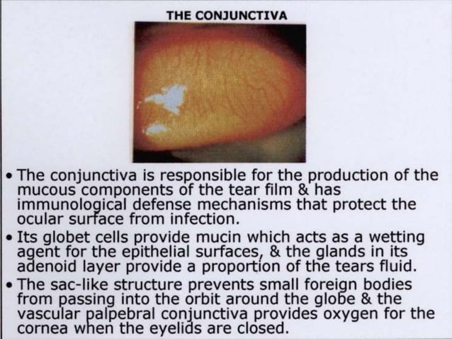 4 Conjunctival disorders Oghre.pptx