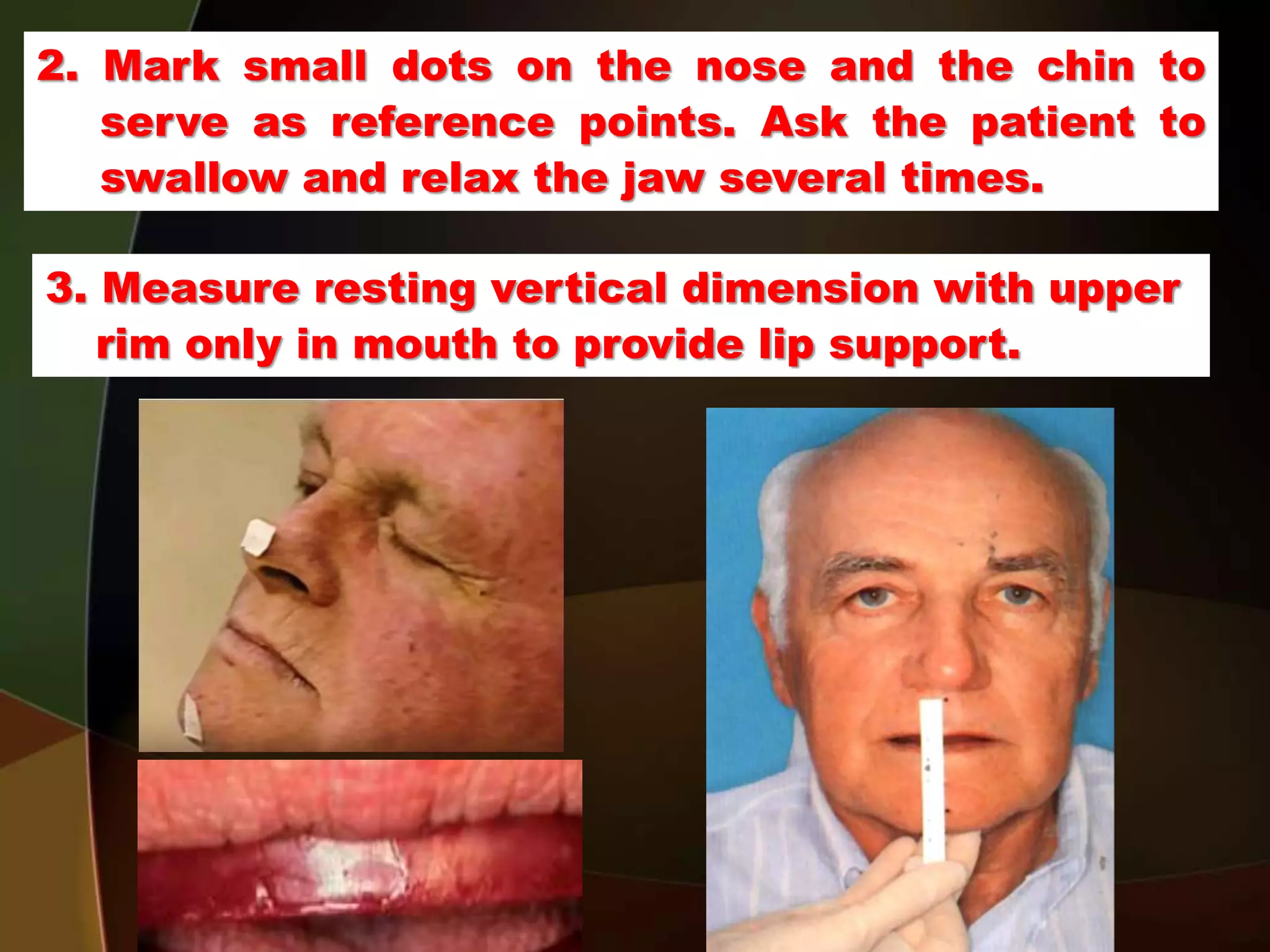 Clinical Steps for Complete Denture Construction -Steps of recording ...