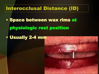 Clinical Steps for Complete Denture Construction -Steps of recording ...