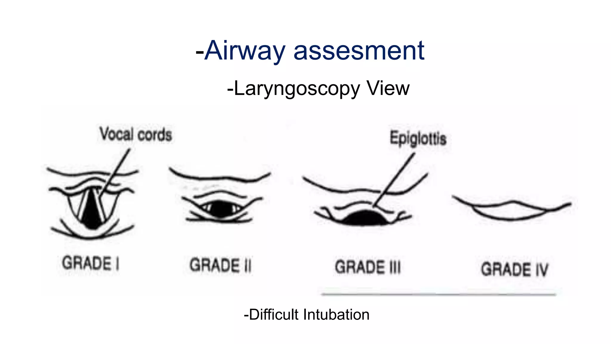 difficult airway management-Anesthesia | PDF