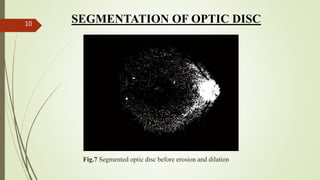 Design and development of an early optical disease recognition system ...