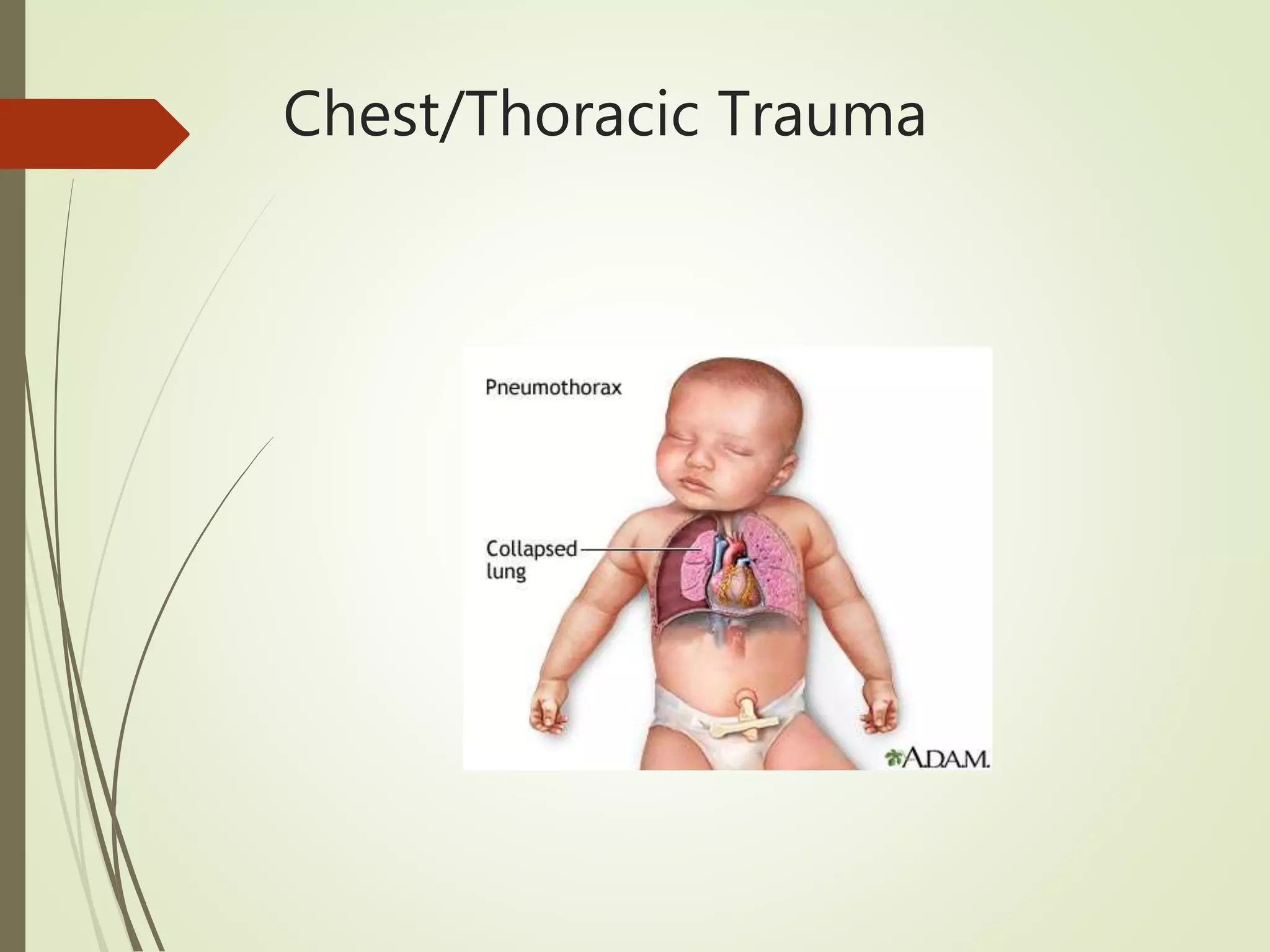 Pediatric Trauma | PPTX