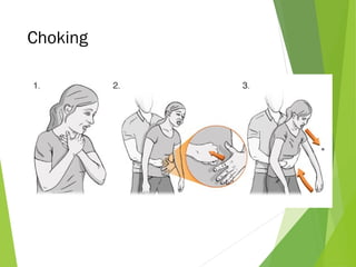 First Aid_New | PPT