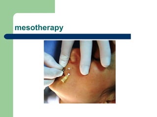 mesotherapy | PPT