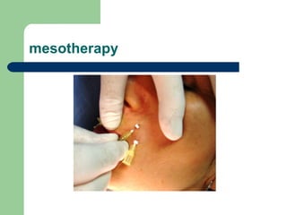 mesotherapy | PPT