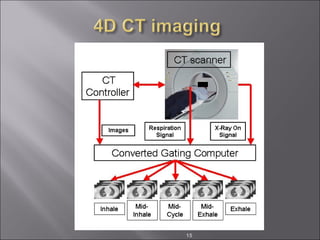 4 dcrt, FourDimensionalConventionalRadiationTreatment | PPT