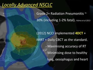4DCT driving improved lung radiotherapy outcomes at NCCI | PPTX