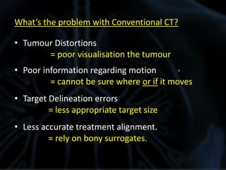 4DCT driving improved lung radiotherapy outcomes at NCCI | PPT