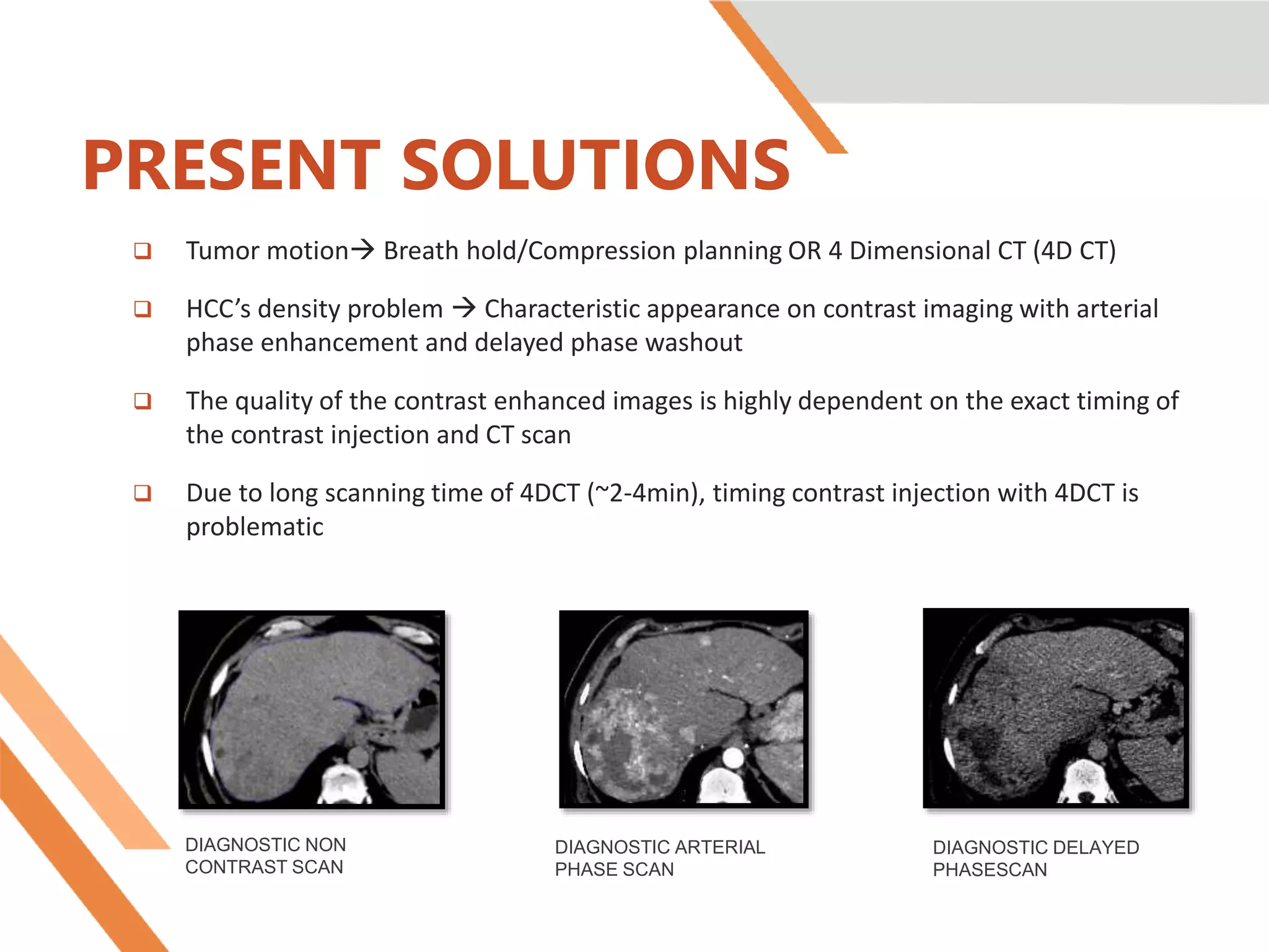 4 D CT simulation with synchronized intravenous contrast injection | PPTX