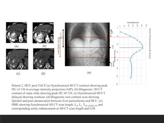 4 D CT simulation with synchronized intravenous contrast injection | PPTX