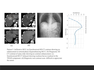 4 D CT simulation with synchronized intravenous contrast injection | PPTX