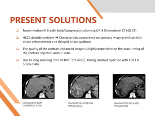 4 D CT simulation with synchronized intravenous contrast injection | PPTX