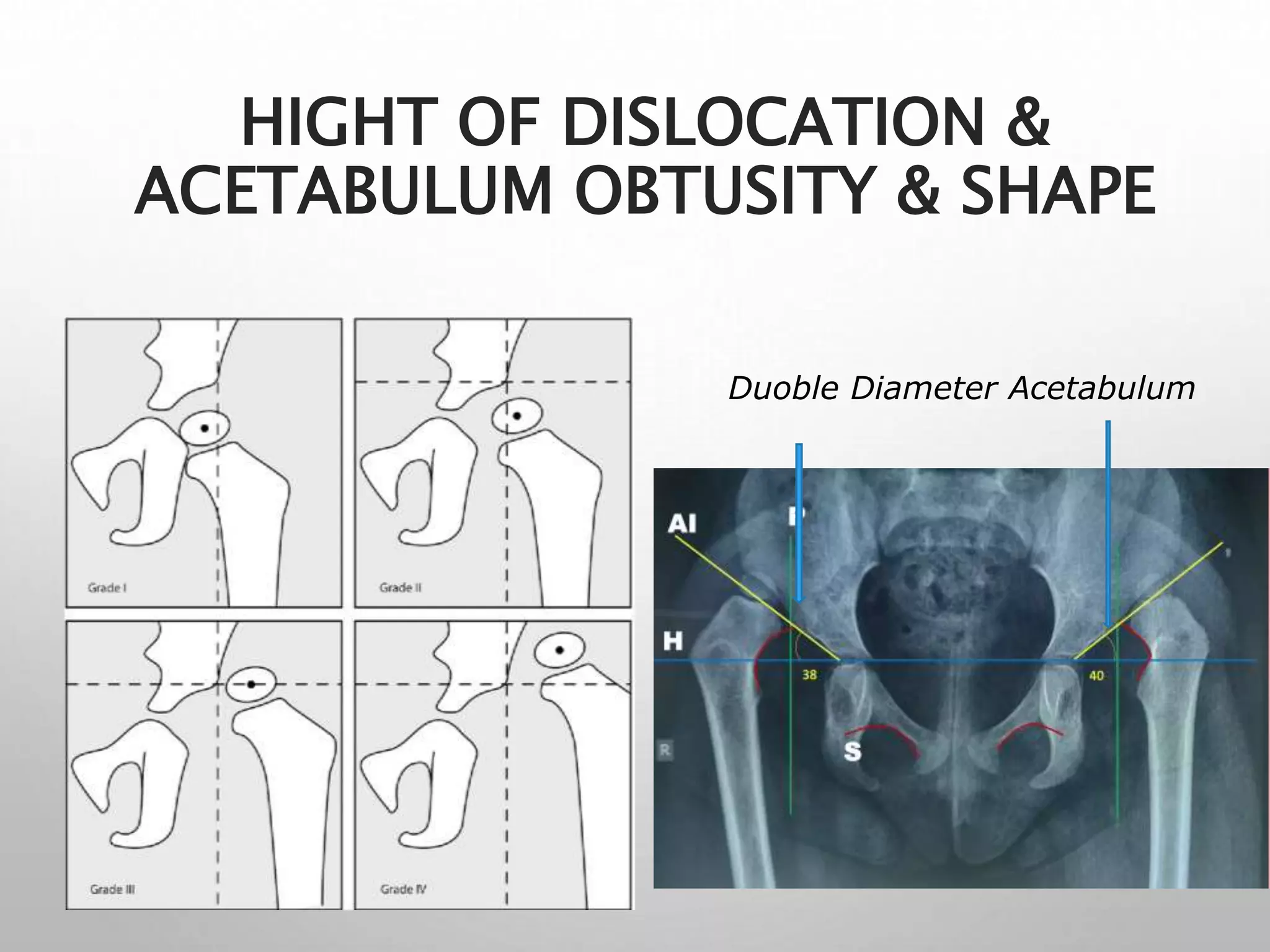 4 ddh principles & protocols 3 & above | PPT