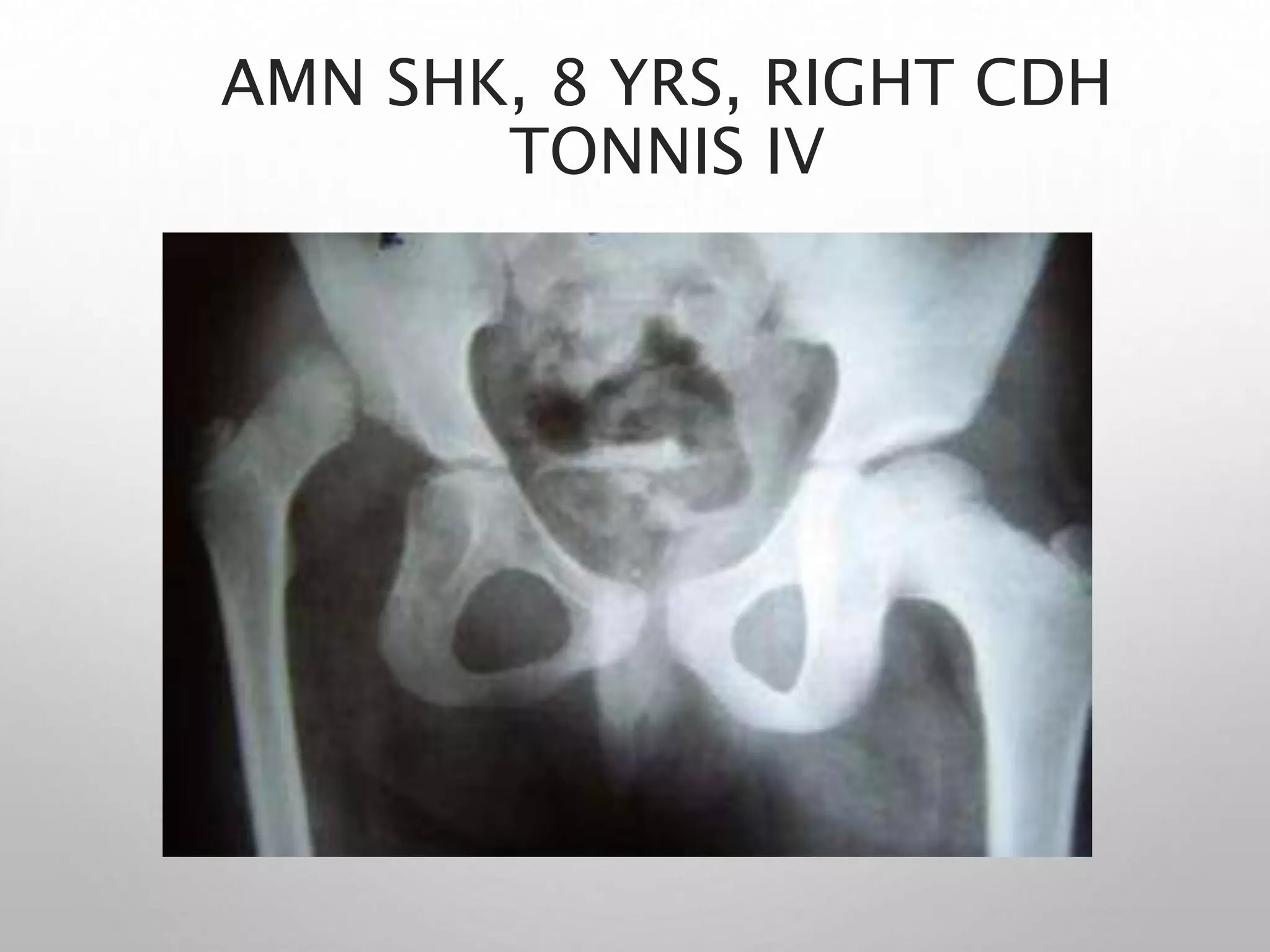 4 ddh principles & protocols 3 & above | PPT