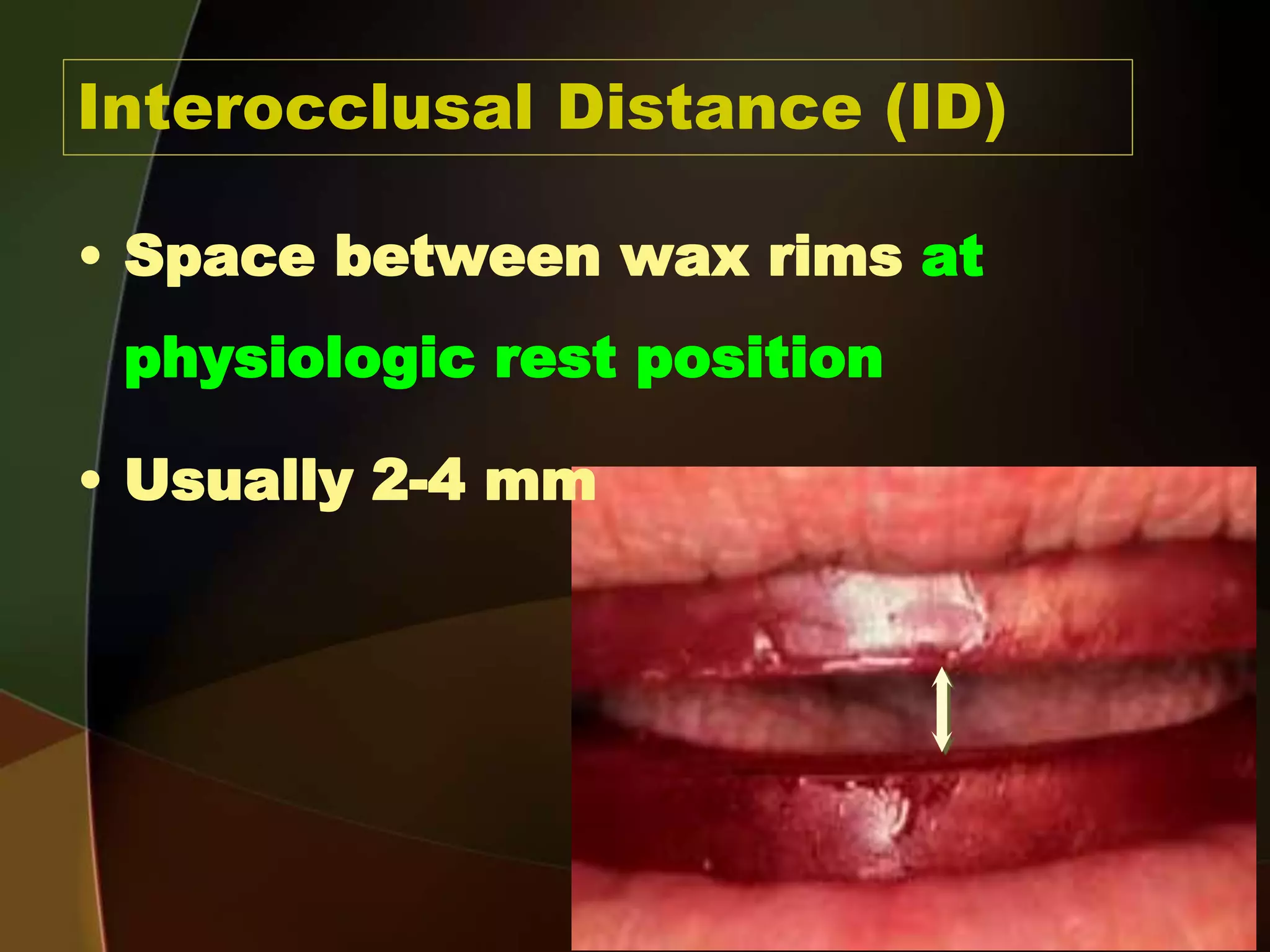 Complete Denture 4- Maxillo-mandibular Relation Records d- Vertical ...