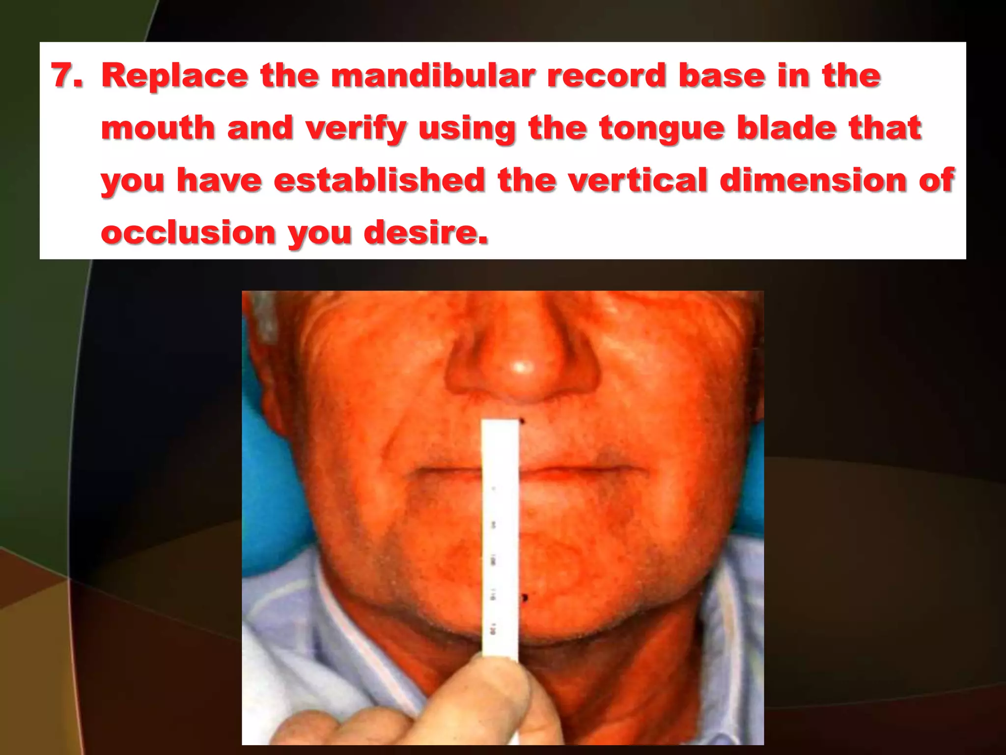 Complete Denture 4- Maxillo-mandibular Relation Records d- Vertical ...