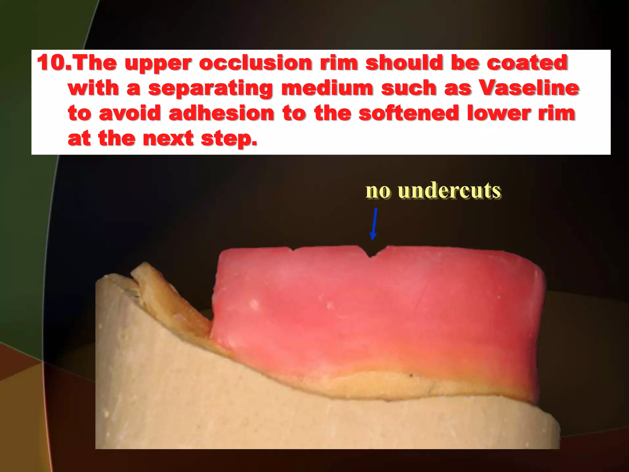 Complete Denture 4- Maxillo-mandibular Relation Records d- Vertical ...
