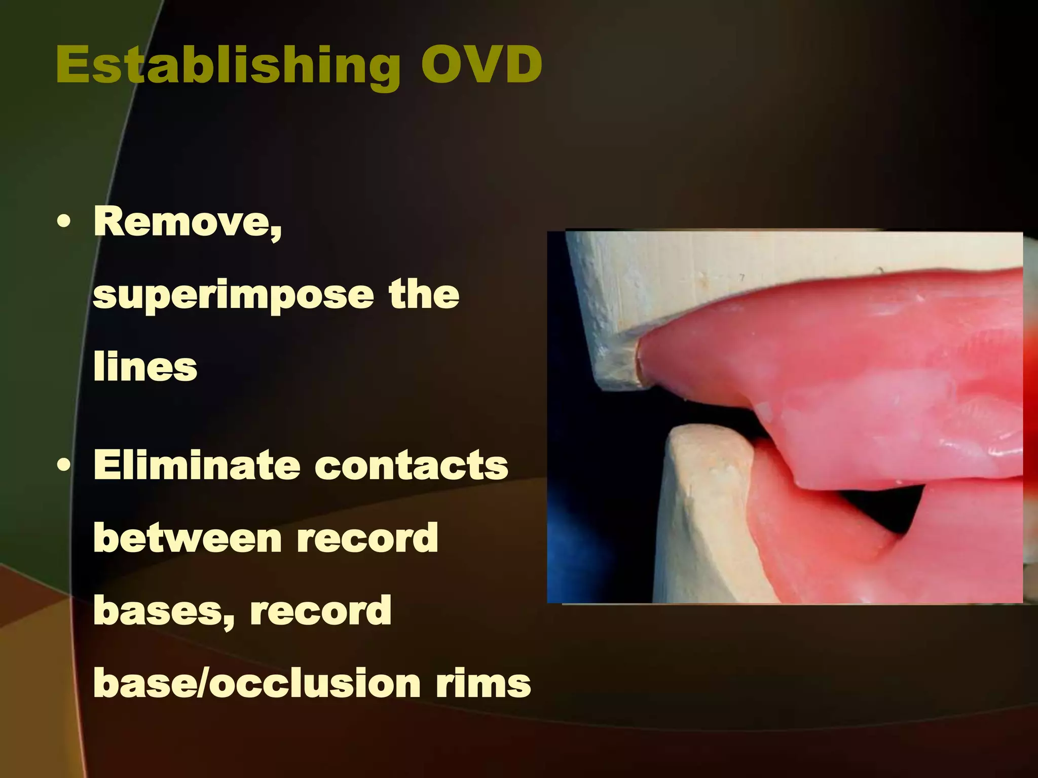 Complete Denture 4- Maxillo-mandibular Relation Records d- Vertical ...