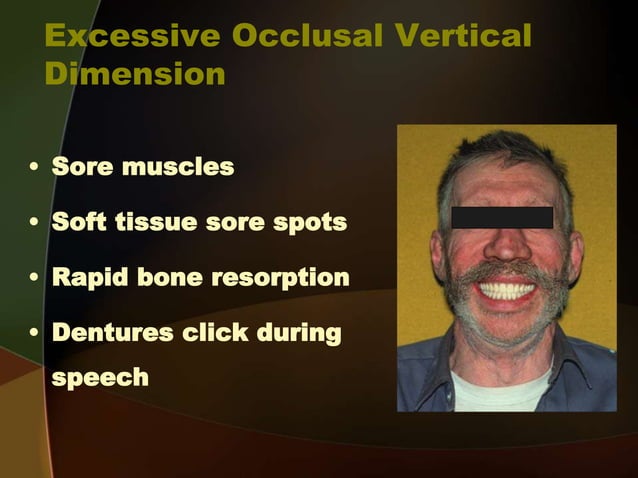 Complete Denture 4- Maxillo-mandibular Relation Records d- Vertical ...