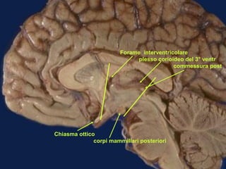 w 4 diencefalo.pdf