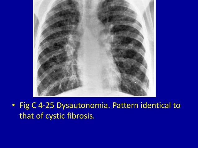 4 diffuse reticular or reticulonodular pattern | PPTX