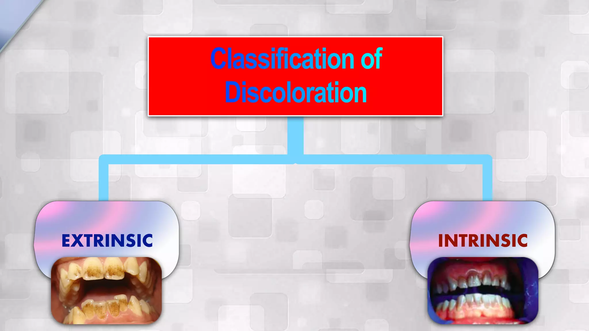 Tooth Discoloration | PDF