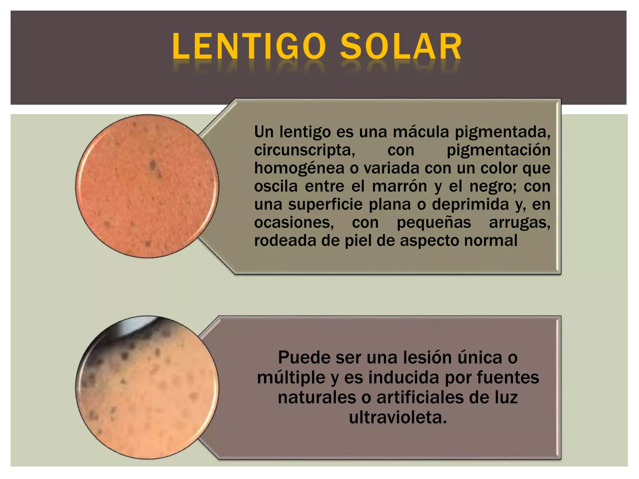 4 discromias - dermatologia | PPTX | Skin and Dermatology | Diseases ...