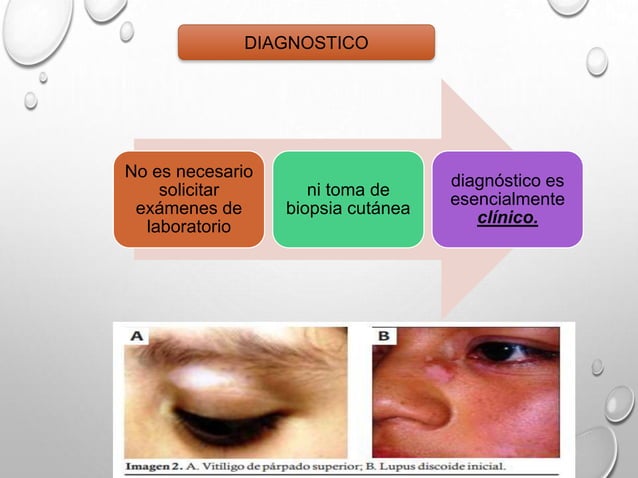 4 discromias - dermatologia | PPTX | Skin and Dermatology | Diseases ...