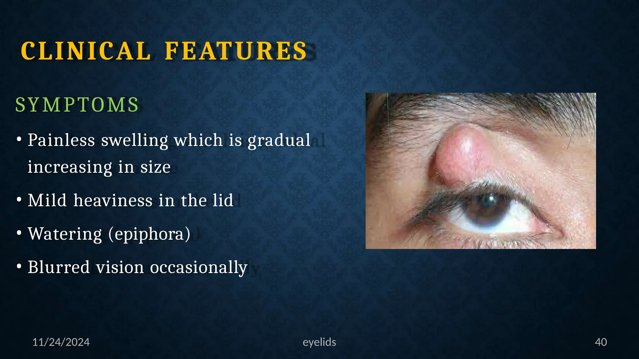 for eye human disorders of eyelids.pptx