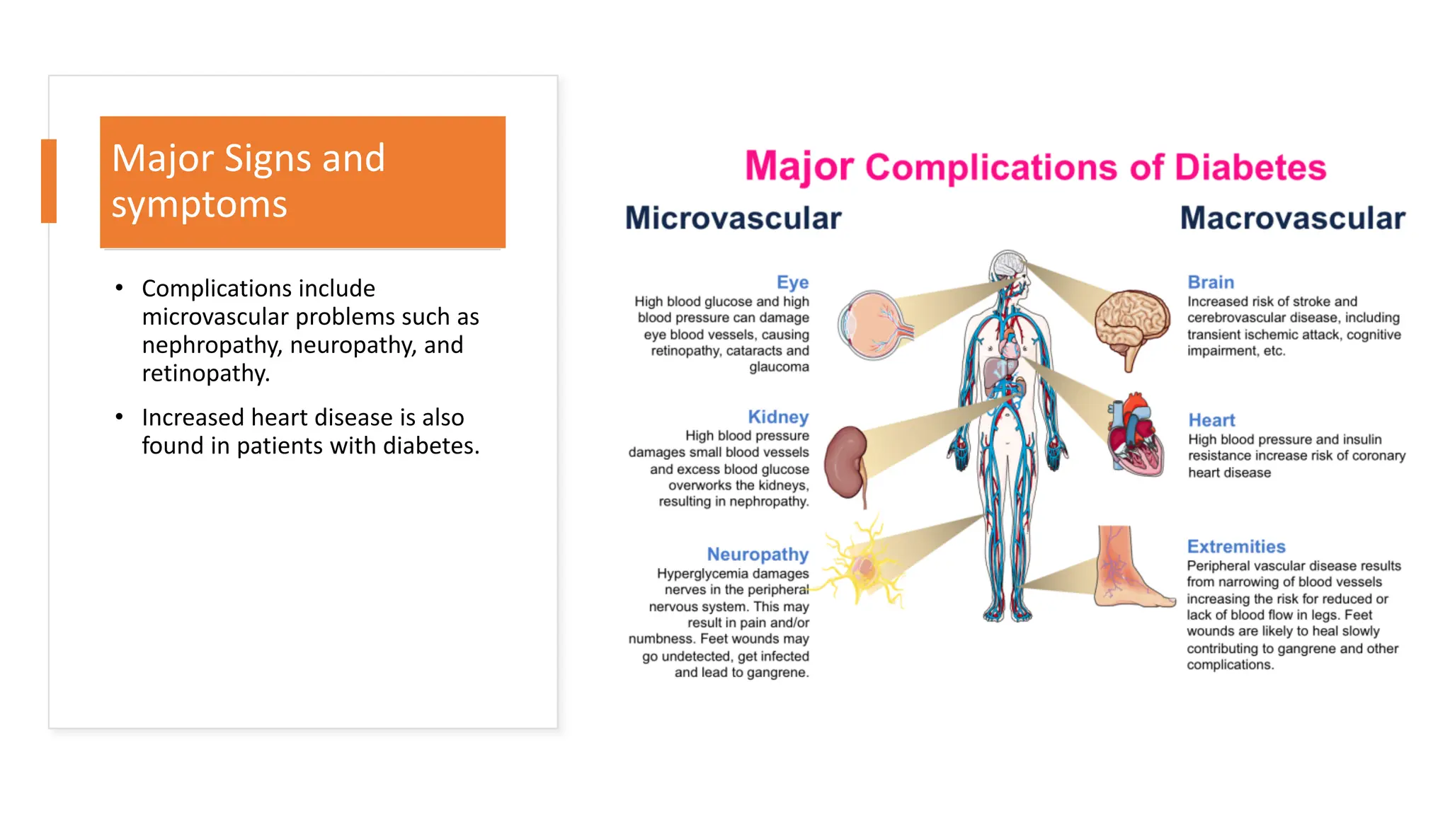 diabetes Mellitus type 1simple introduction | PDF