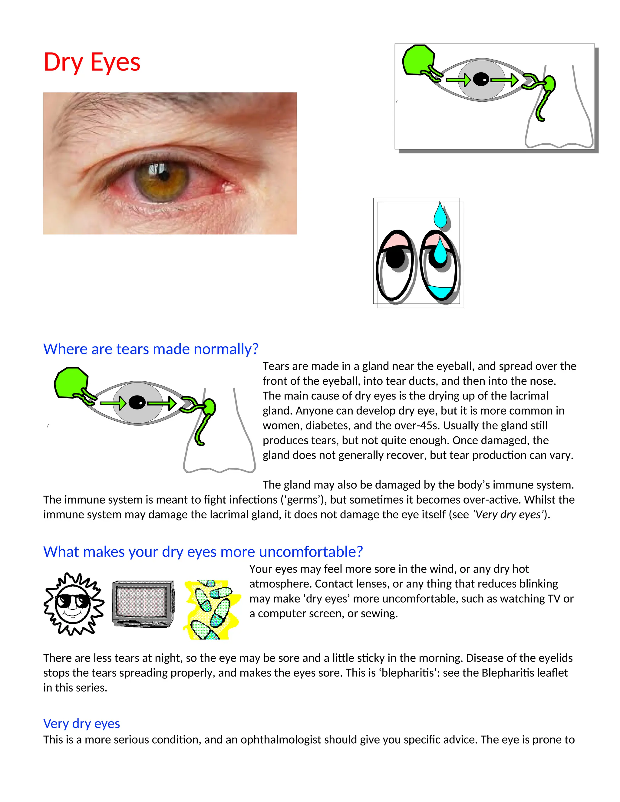Dry Eyes educational pamphlet for patients | DOCX