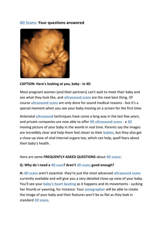 4D scans - your questions answered | PDF