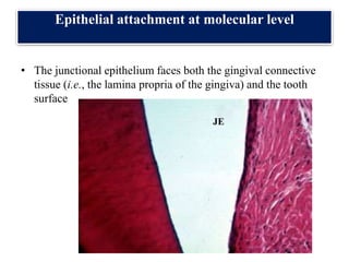 Epithelial Attachment Epithelium Junctional Junctional Junctional ...