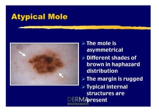 Molemax Presentation | PPT
