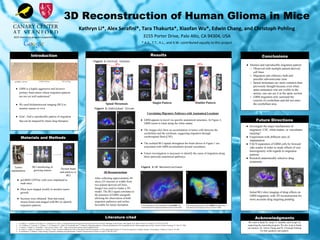 Migration of GBM Poster | PPT