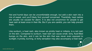 4 effective ways to prevent heat rash | PPT
