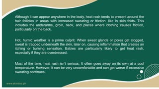 4 effective ways to prevent heat rash | PPT
