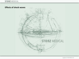 Effects of shock waves | PPT