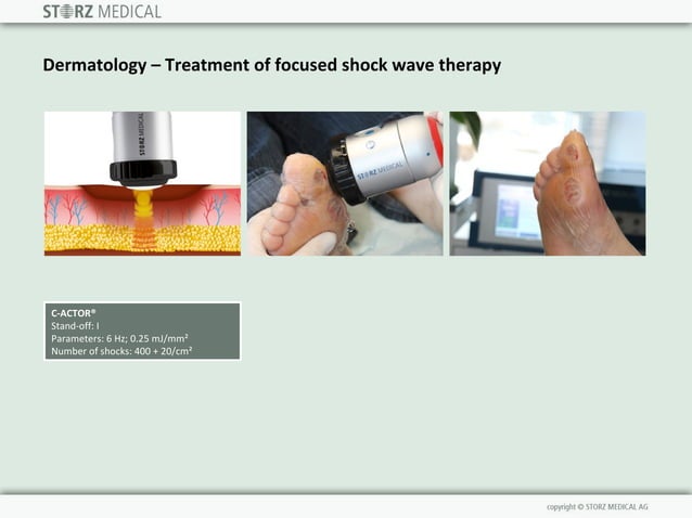 Effects of shock waves | PPT