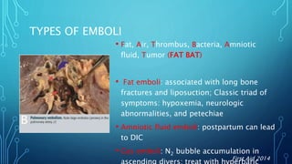 4 Embolie Pulmonaire.pdf