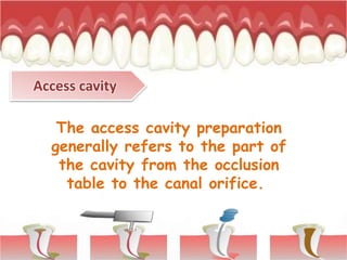 Access Cavity Preparation in : Maxillary Lateral Incisor | PPTX