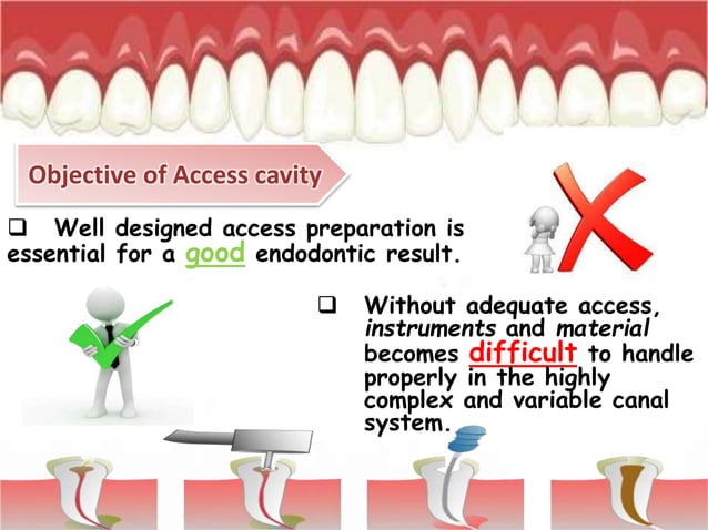 Access Cavity Preparation in : Maxillary Lateral Incisor | PPTX