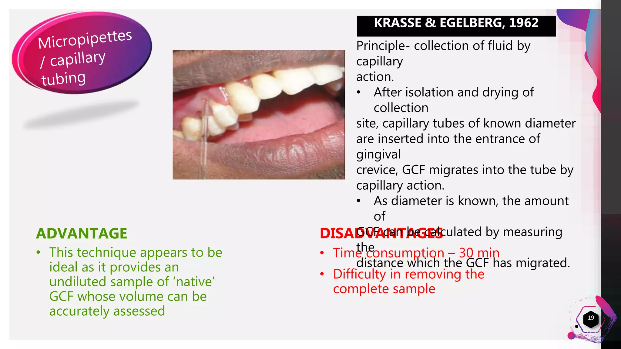 GINGIVAL CREVICULAR FLUID | PPTX