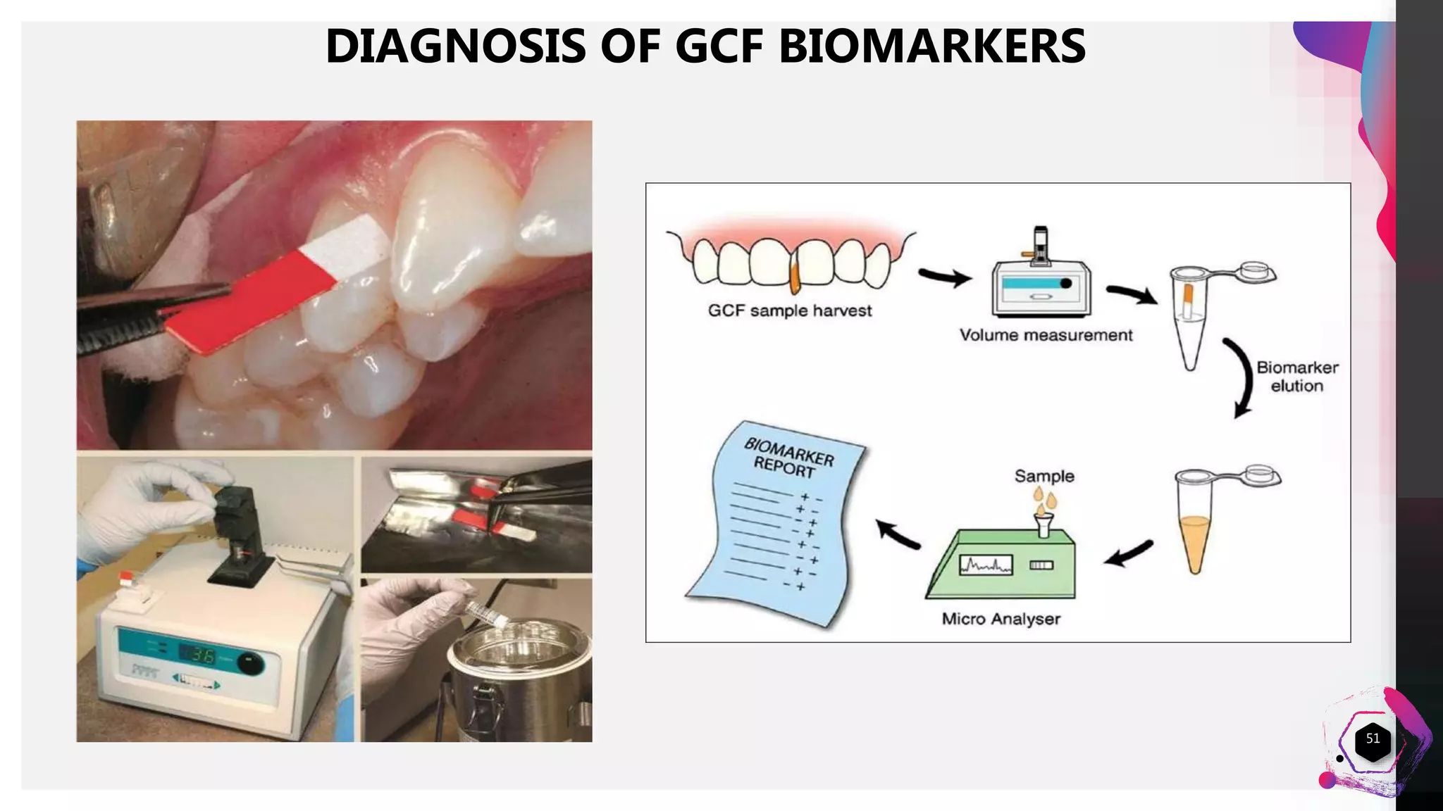 GINGIVAL CREVICULAR FLUID | PPTX